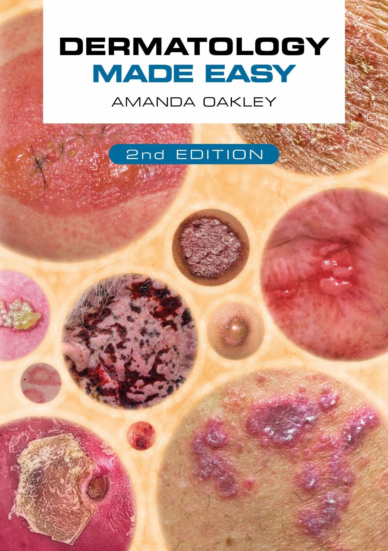 Dermatology Made Easy, second edition | Scion Publishing