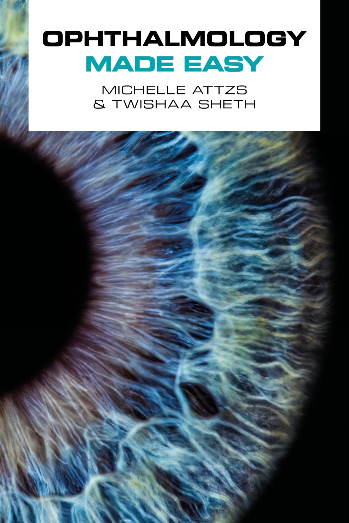 Ophthalmology Made Easy | Scion Publishing